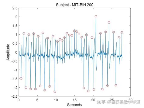 请问经验模态分解和小波变换对比有什么优缺点？ 知乎