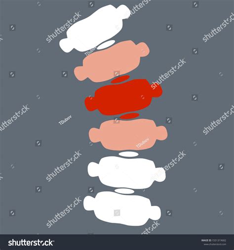 Problems Spine Posture Issues Vertebral Column Stock Vector Royalty Free 1551319682 Shutterstock