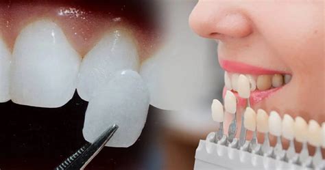 دندانپزشکی اطفال چیست و چه خدماتی ارائه میکند؟