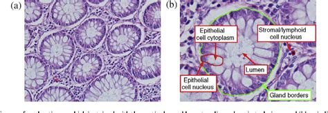 Figure 1 From Automatic Segmentation Of Colon Glands Using Object Graphs Semantic Scholar