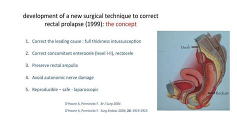 Rectal Prolapse Do We Really Have A Perfect Surgical Solution Pptx
