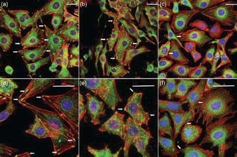 3 Immunofluorescence Staining Green Fluorescence Of Vinculin AÀc