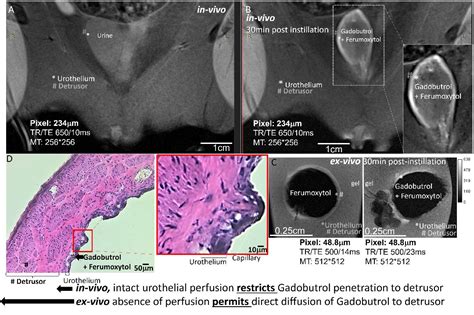 Ics Eus 2025 Abstract 202 In Vitro In Vivo Correlation Ivivc Analysis Reveals The Integral