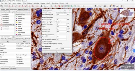 How To Set Reasonable Cell Detection Parameters To Detect Map2 Positive Neuronal Cells Where
