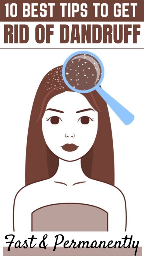 10 Best Tips To Get Rid Of Dandruff Fast Permanently At Home Dandruff Getting Rid Of Dandruff