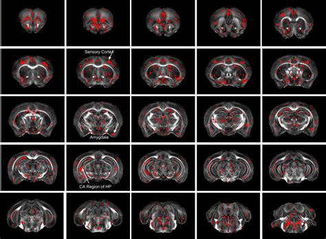 Figures And Data In Early Life Stress Causes Sex Specific Changes In Adult Fronto Limbic