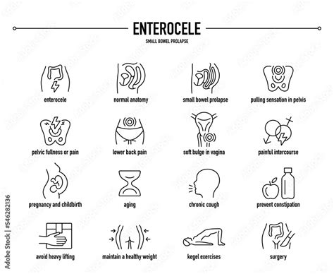 Enterocele Small Bowel Prolapse Symptoms Diagnostic And Treatment