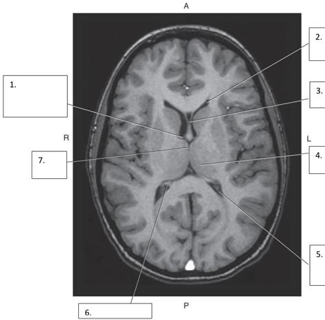 Unit 2 Ch 3 Graph 1 Diagram Quizlet