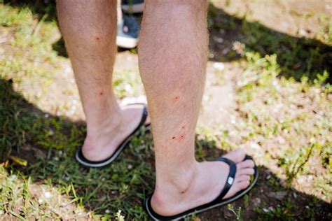 Cómo Protegerse De Los Jejenes O Mosquitos Diminutivos Phifer