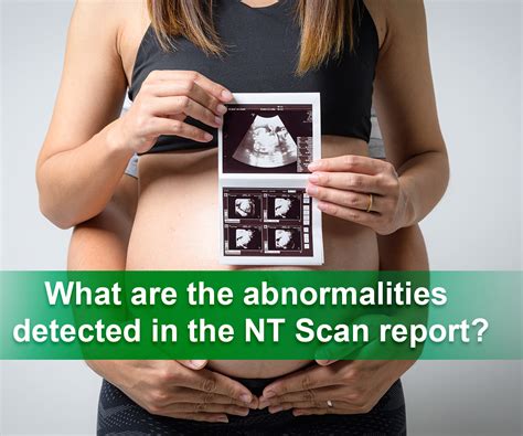 Abnormalities Detected In The NT Scan Report A Comprehensive Guide In