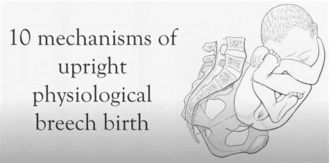 Breech Birth An Overview — Born Strong Doula Services Llc