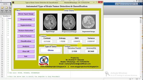 Types Of Brain Tumor Detection And Classification Using Matlab Project Code Brain Tumor