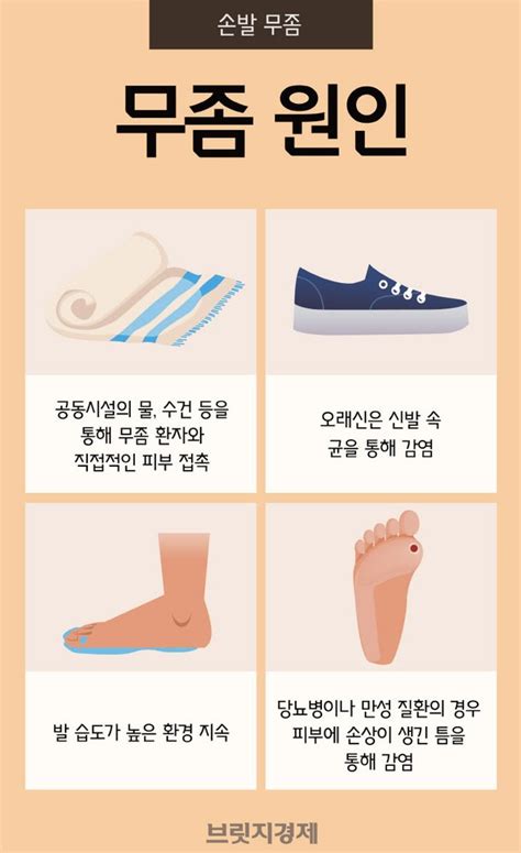 [카드뉴스] 간질간질 무좀 어떻게 잡을까 네이트 뉴스