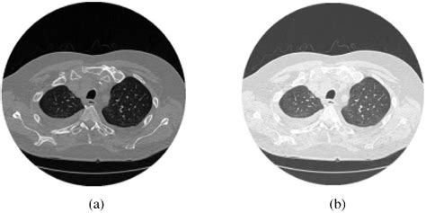 Figure 1 From Lung Nodule Detection Based On Yolov3 Deep Learning With