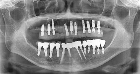 하루에 치료하는 치과 하루에치과