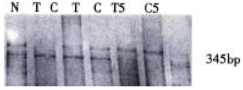 Polymorphism Of P16ink4a Gene And Rare Mutation Of P15ink4b Gene Exon2