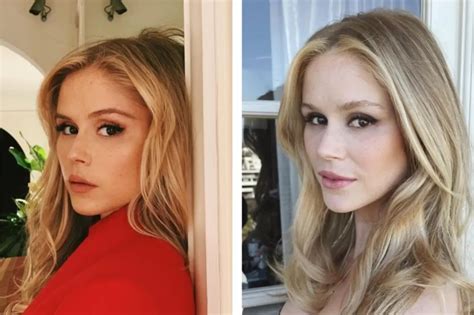 Erin Moriarty Before And After Cosmetic Surgery Did She Really Get