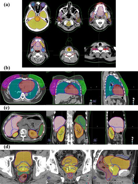 Clinical Evaluation Of Deep Learning And Atlas Based Auto Segmentation