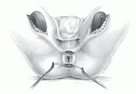 C FF Gif Abdominal Key