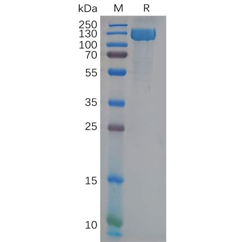 Buy Human Anpep Protein His Tag Anpep Recombinant Protein Dima Biotech