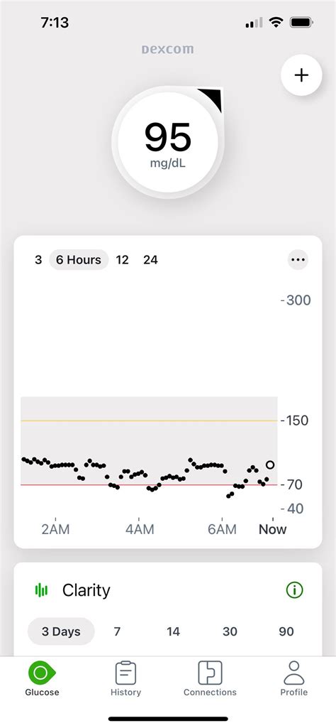 Bad Sensor Rdexcom