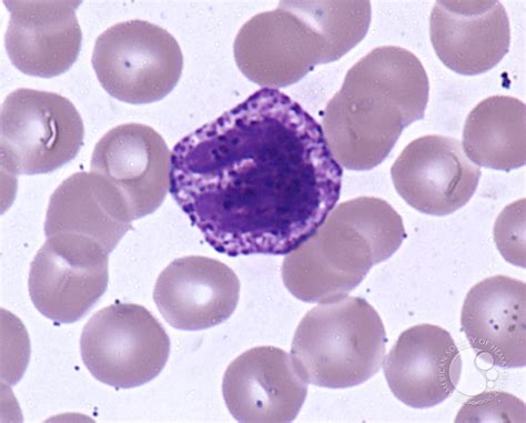 Basophils 2