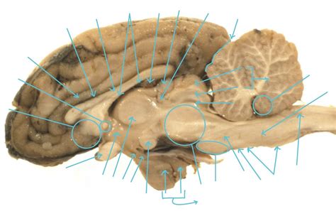 Median Plane Sheep Brain Diagram Quizlet