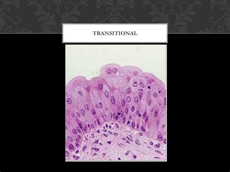 PPT Simple Squamous PowerPoint Presentation Free Download ID 2420709