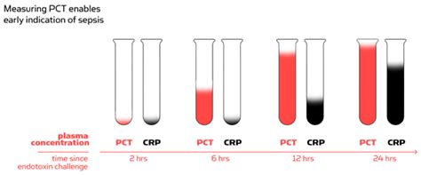Early Detection Of Sepsis With Procalcitonin Pct Test