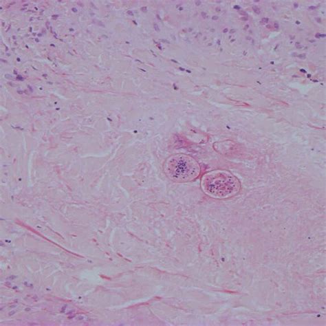 Skin Biopsy Amplification X120 Download Scientific Diagram
