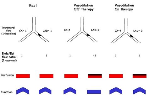 Schematic Illustration Of The Principle Underlying The Impact Of