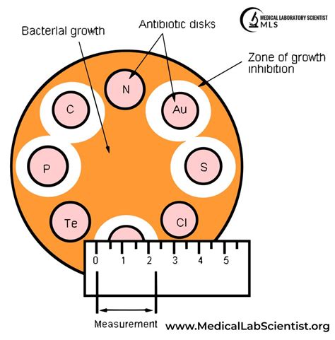 Antibiotic Sensitivity Testing Disc Diffusion Method Medical Laboratory Scientist Mls