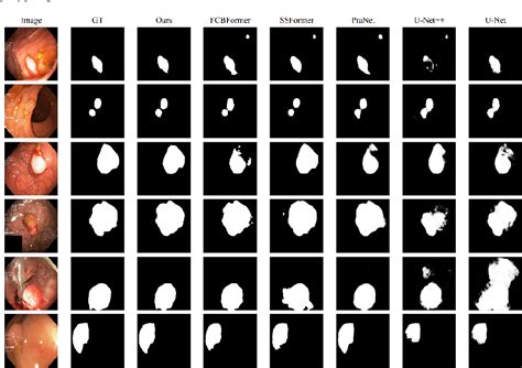 Figure 7 From Improved Dual Aggregation Polyp Segmentation Network