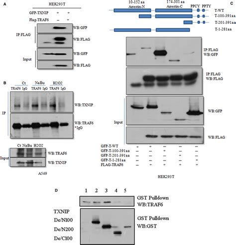 Txnip Interacts With Traf6 Via Ppxy Motif And Nabu Strengthens Download Scientific Diagram