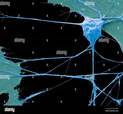 Corpo Cellulare Dei Neuroni Immagini E Fotografie Stock Ad Alta