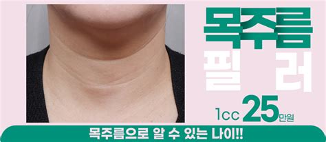목주름필러1cc 루비성형외과의원