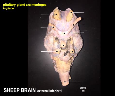 Sheep Brain External Inferior 1 Diagram Quizlet