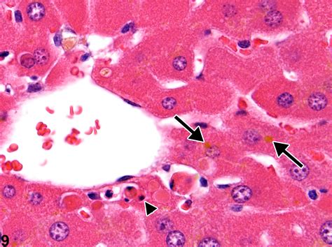 Liver Hepatocyte Hypertrophy Nonneoplastic Lesion Atlas