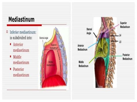 Mediastinal Anatomy Classification Of Mediastinal Masses Ans Its Loc