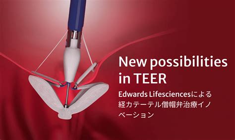 Pascal Precision システム Edwards Lifesciences Pascal Precision システム Edwards Lifesciences