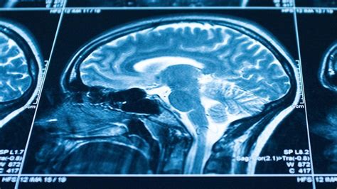 Researchers Demonstrate Brainwave Synchronization Without Physical Presence