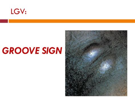 STDs Flashcards Quizlet