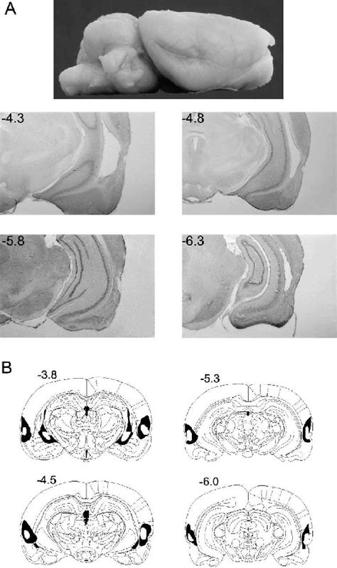 Figure 1 From Perirhinal Cortex Lesions Produce Retrograde Amnesia For
