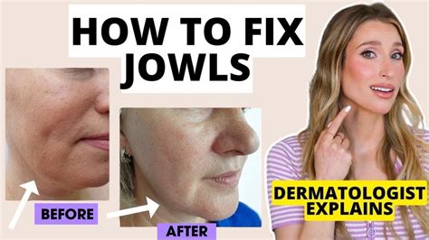 How To Fix Jowls Dermatologist Explains How To Prevent And Get Rid Of Jowls Dr Sam Ellis Youtube