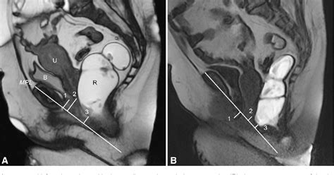 Pdf Dynamic Pelvic Floor Imaging Mri Techniques And Imaging Parameters Semantic Scholar