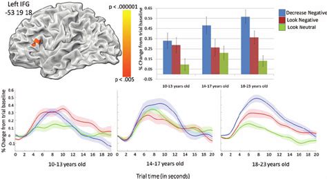 Left Inferior Frontal Gyrus Activation Identified In The Linear