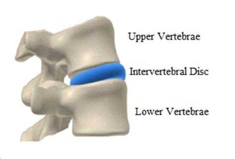 Functional Spinal Unit FSU Download Scientific Diagram