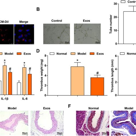 Hucmscs Exos Induce The Repair Of Venous Thrombosis In Rats With Dvt A Download Scientific