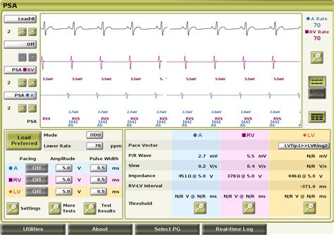 Latitude™ Programming System Model 3300 Boston Scientific
