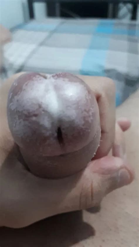 Wet Glans Penis 11 Pics Xhamster